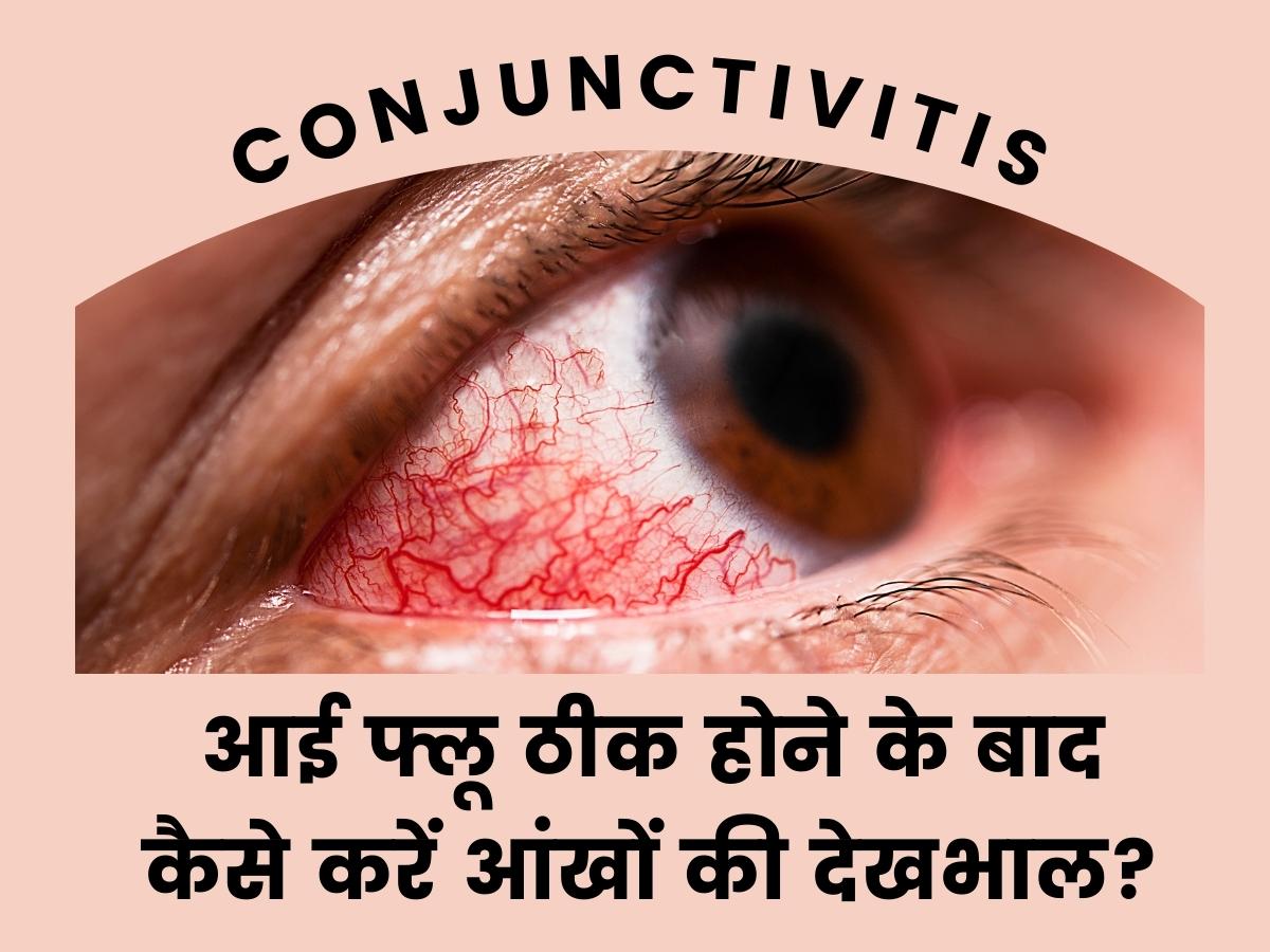 Conjunctivitis treatment tips to follow after recovery from eye flu otherwise your eyes get ...