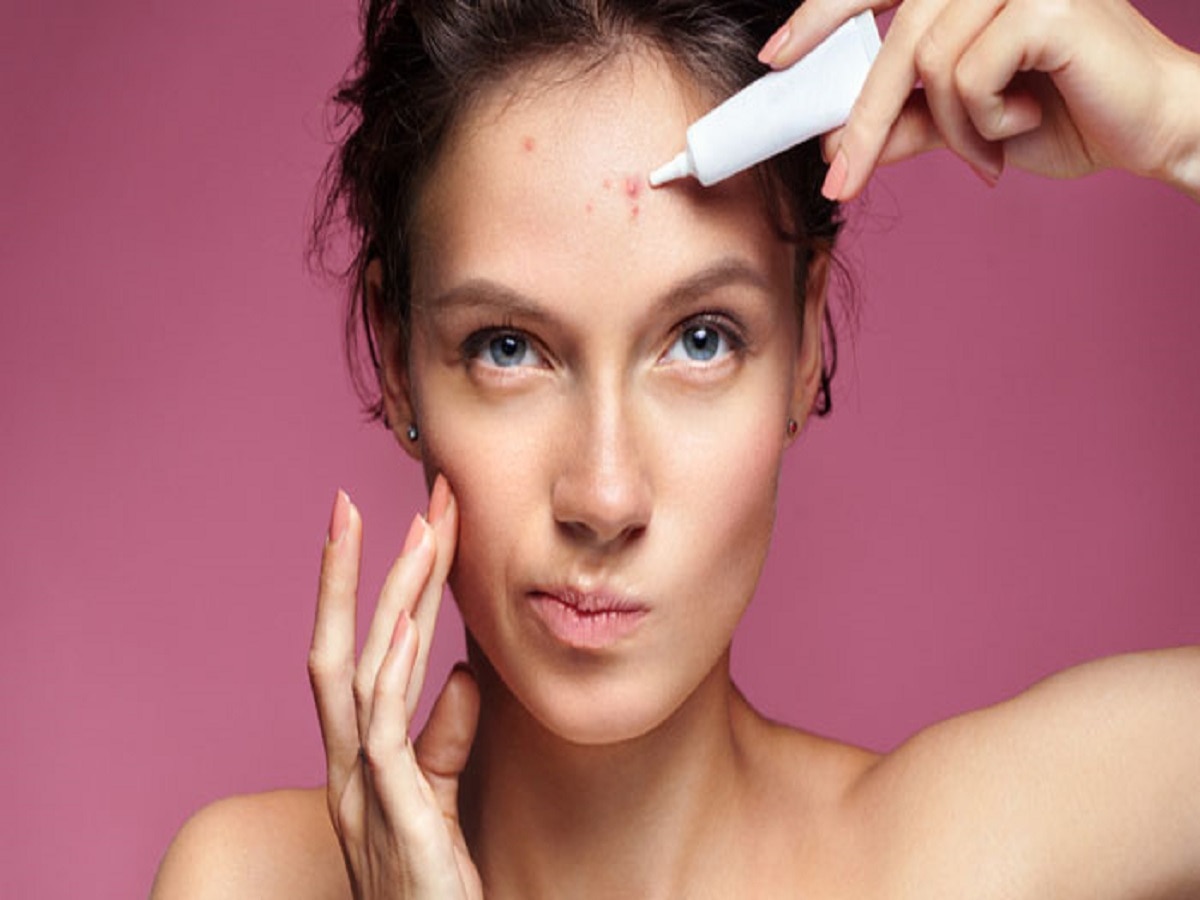 This Home Remedy Will Get Rid Of Pimples Make Your Face more Beautiful