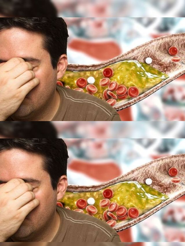 blood purification foods include your diet control cholesterol and ...