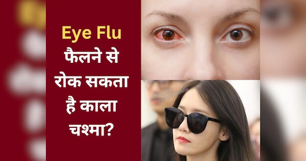 Can Wearing Black Glasses Prevent Eye Flu Conjunctivitis From Spreading Virus To Other People ...