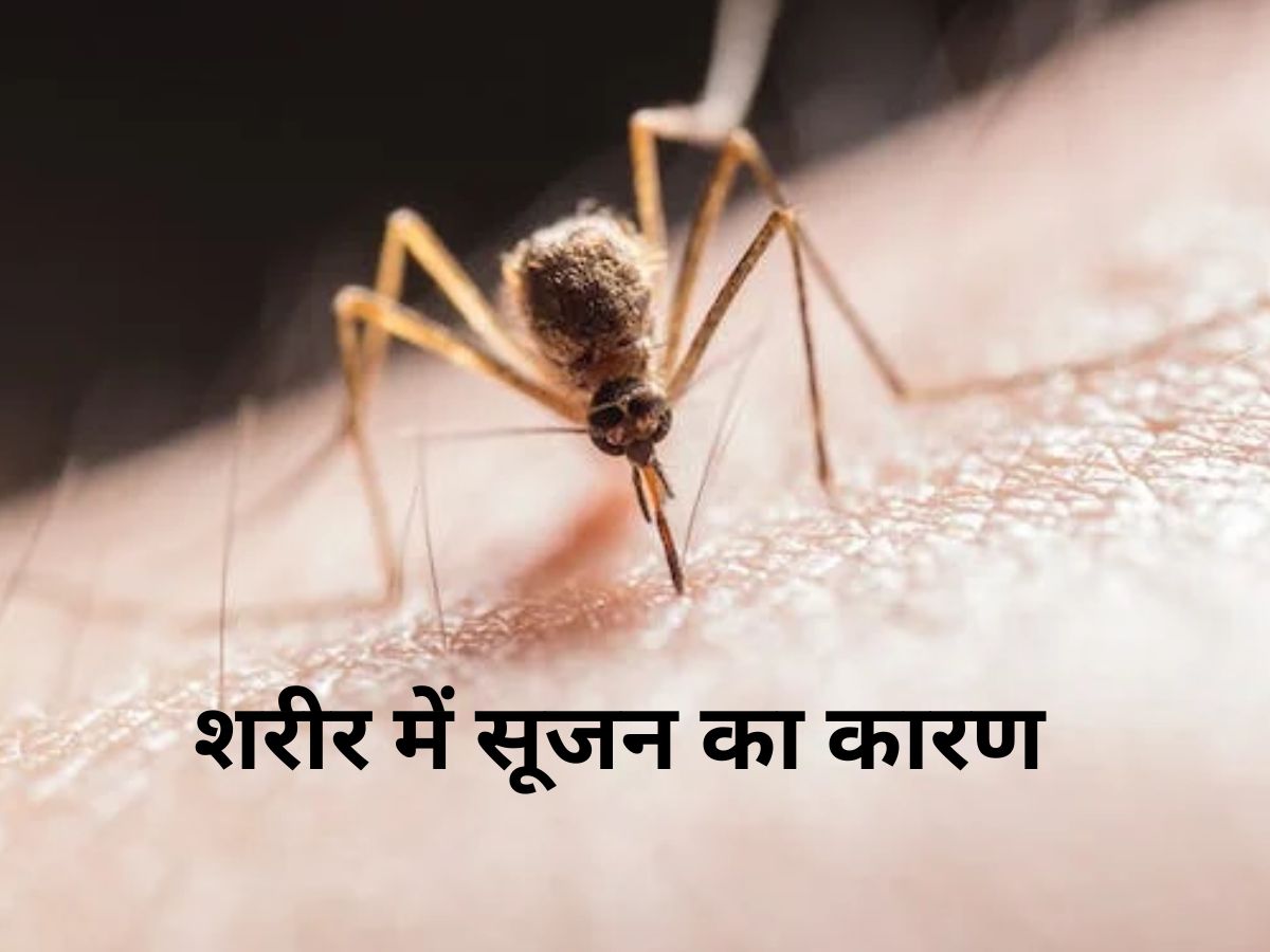 body parts swelling after insect biting reason will surprise you ...