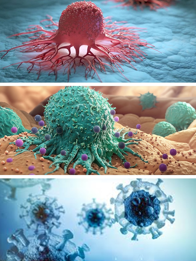 Best Cancer Hospital in Uttar Pradesh know Chemotherapy Radiation ...