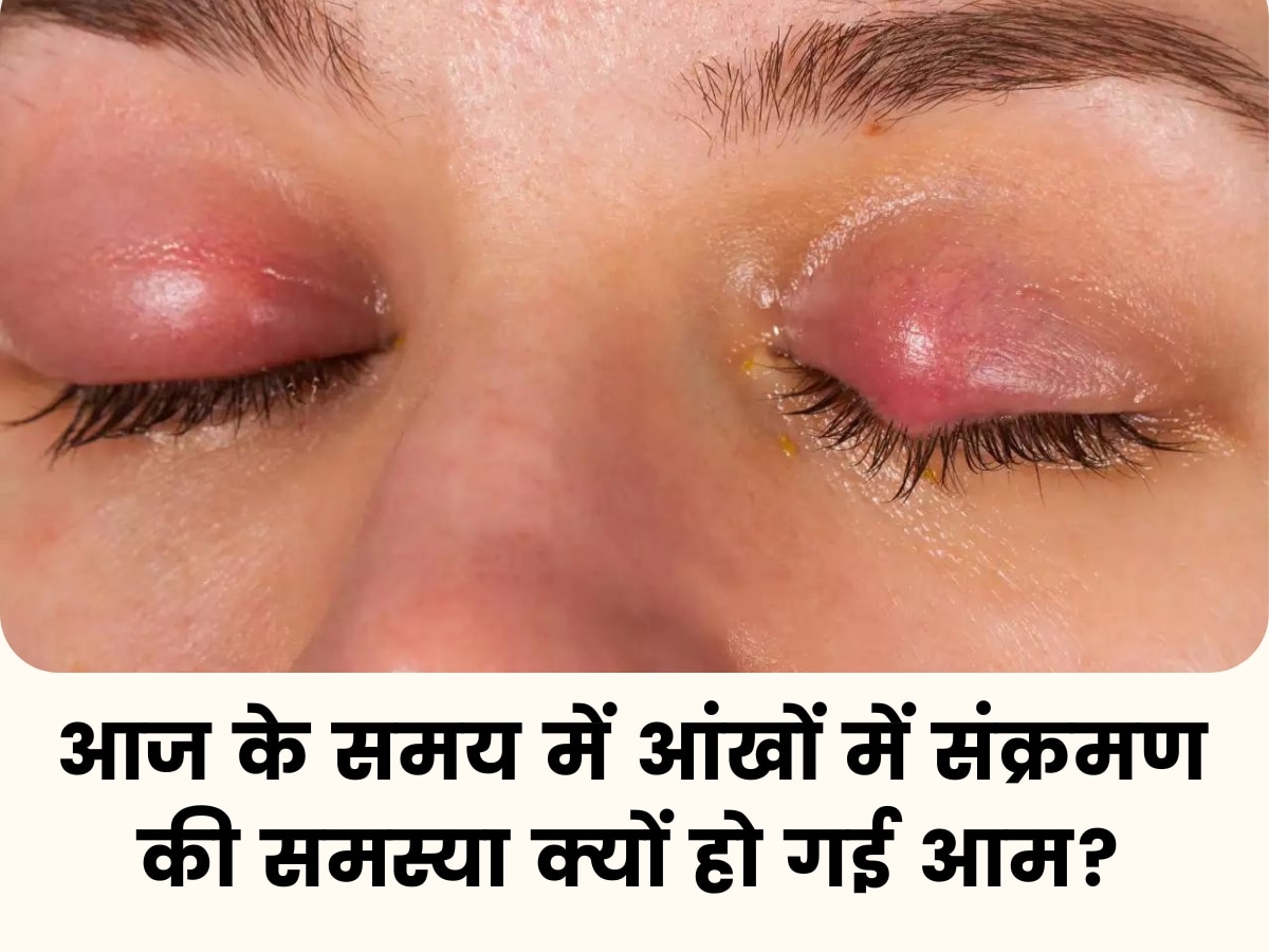 why eye infection is getting very common now a days does climate change ...