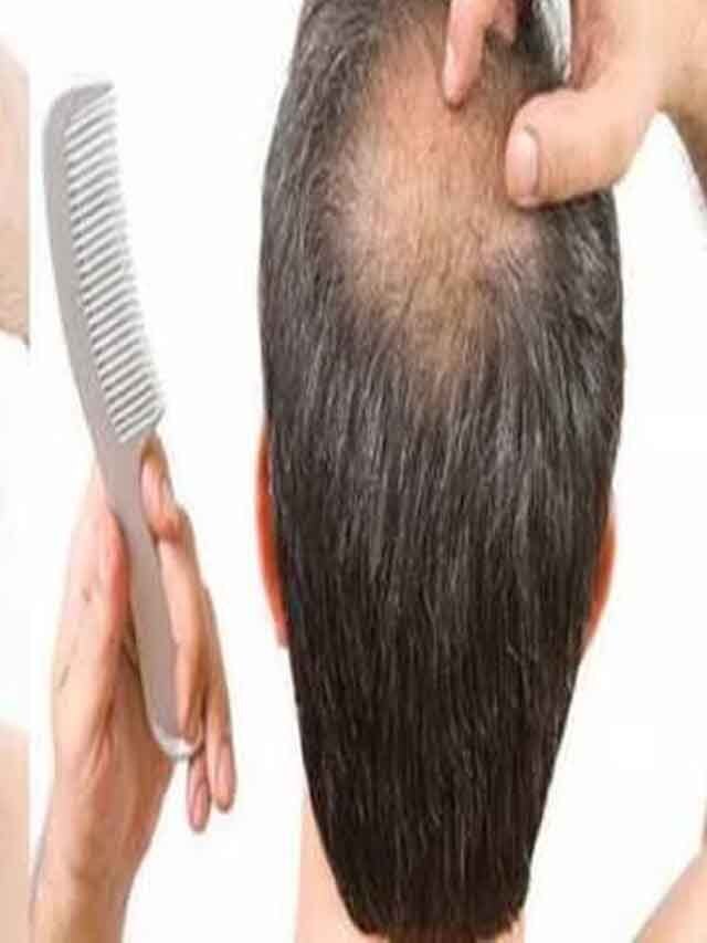 wrost food for hair loss avoid this ganjapan kaise roke | रोज खाएंगे ये ...