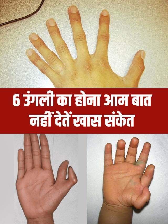 samudrik shastra meaning of having 6 fingers in hand konw hath mein 6 ...