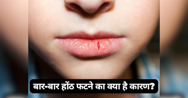What is the main reason for frequent cracked lips is there any danger ...