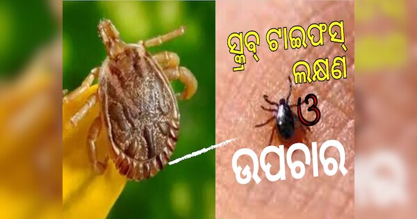 What is scrub typhus that is causing people to fall ill? Know symptoms ...