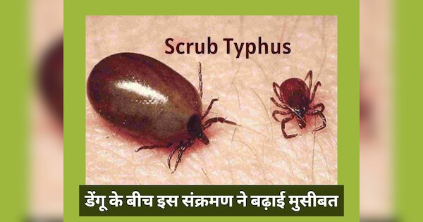 Deadly infection scrub typhus increased trouble people amidst dengue ...