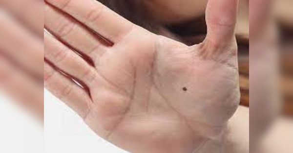 mole astrology mole on palm in these areas indicate wealth prosperity ...