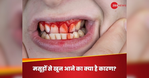 Vitamin k deficiency leads to bleeding gums start eating these 5 foods ...