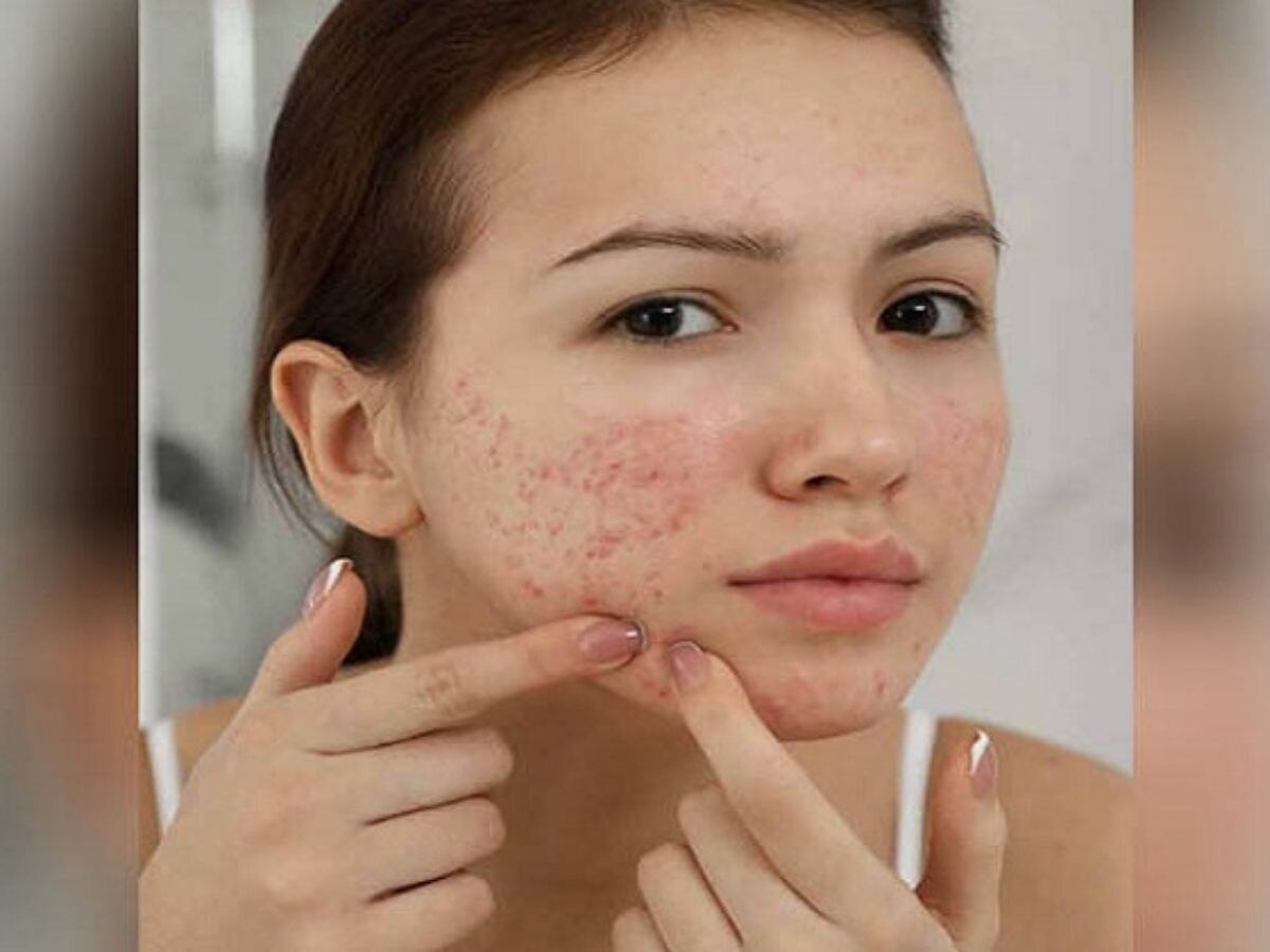 skin benefits of applying nutmeg on face chehre par jaiphal lagane ke ...