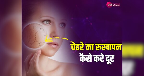 Dry Cheeks winter home remedy cracked skin care solution lifestyle ...