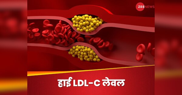 High LDL-C level is very dangerous for the heart know 6 main reasons ...
