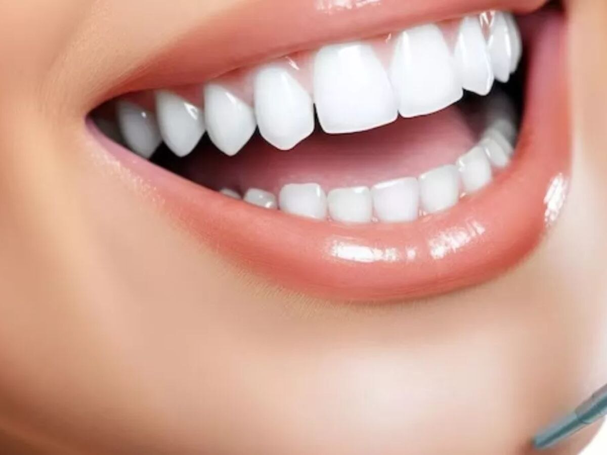 home remedies to clean yellow teeth danto ke pile pan ka ilaj in hindi ...