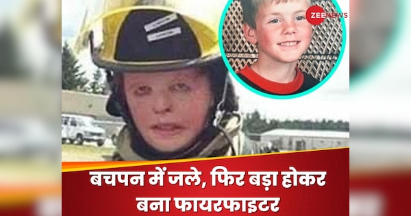 Boy body badly burnt at the age of 6 he become firefighters | Inspiring ...