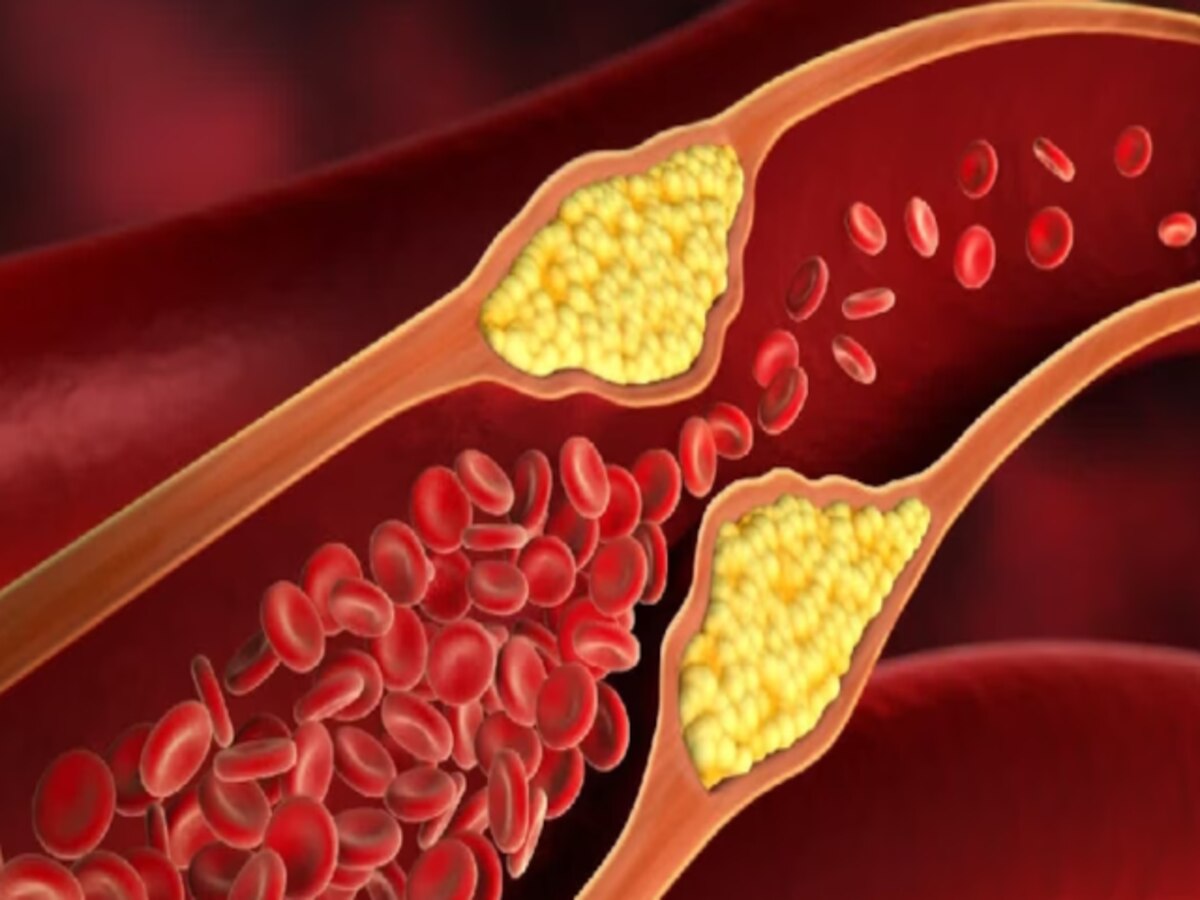 Bathua Juice Benefits in Hindi eating Bathua Properties Nutrients ...