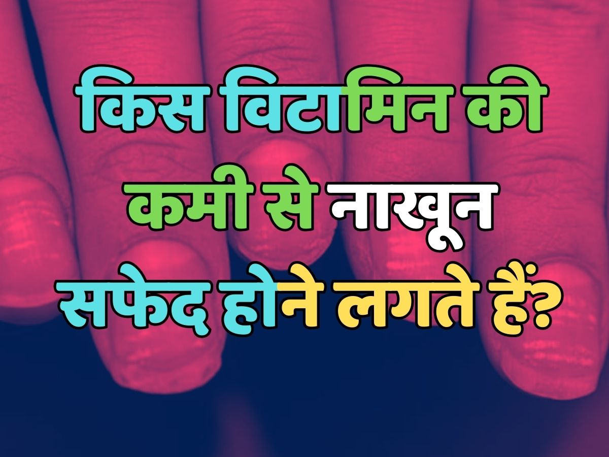 Trending Quiz किस विटामिन की कमी से नाखून सफेद होने लगते हैं