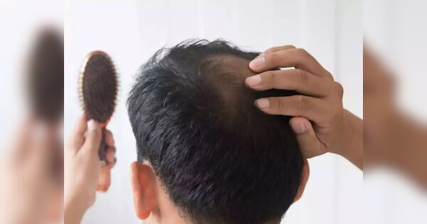 Why does hair fall during cancer treatment Know its prevention from ...