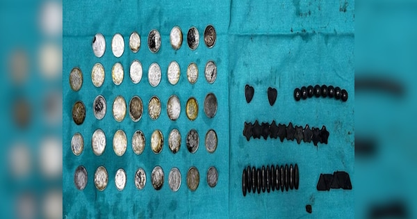 Muscle Building craze gone drastic when a man swallow 39 coins and 37 ...