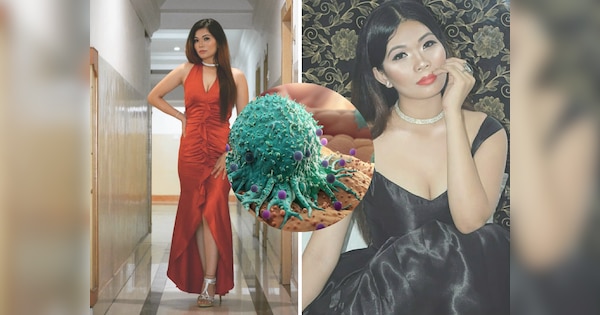 Femina Miss India Tripura 2017 Rinky Chakma died with metastasized breast cancer know the cancer ...