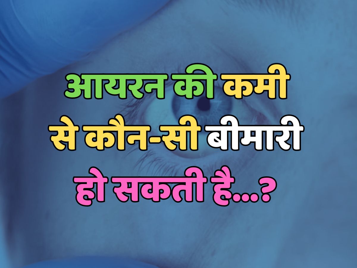Trending Quiz आयरन की कमी से कौन सी बीमारी हो सकती है Trending