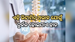 Vitamin K2 Deficiency की ताज़ा खबरे हिन्दी में | ब्रेकिंग और लेटेस्ट ...