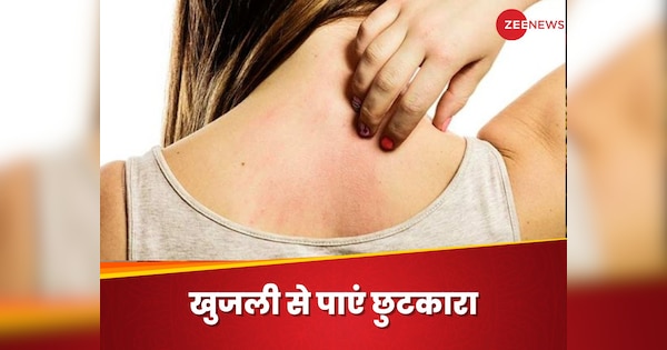 How to get rid of itching and rashes caused by sweat in summer ...