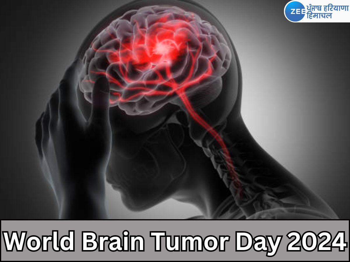 World Brain Tumor Day 2024 What Is World Brain Tumor Day Know Its