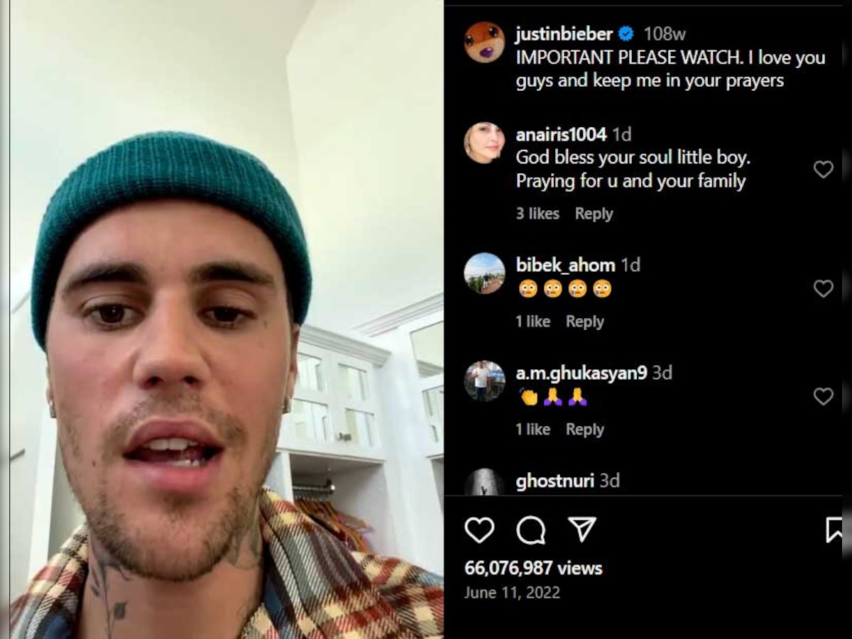 International Pop Singer Justin Bieber Has Ramsay Hunt Syndrome Know ...