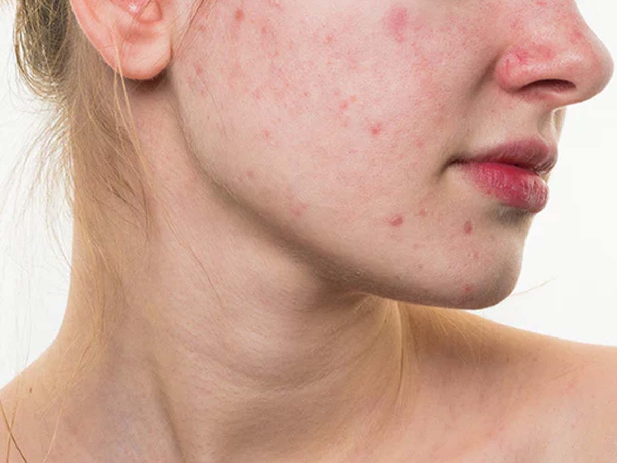 Health Tips in Hindi Bimari ka Sanket Kaise Deta Hai Chehra How does ...