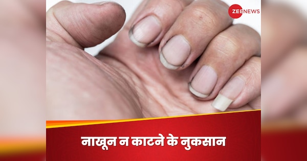 Disease Caused By Not Cutting Nails Nakhoon na katne se hone wali ...