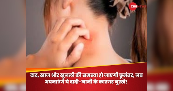 Home Remedies For Ringworm and itching daad khaj khujli ke gharelu upay ...