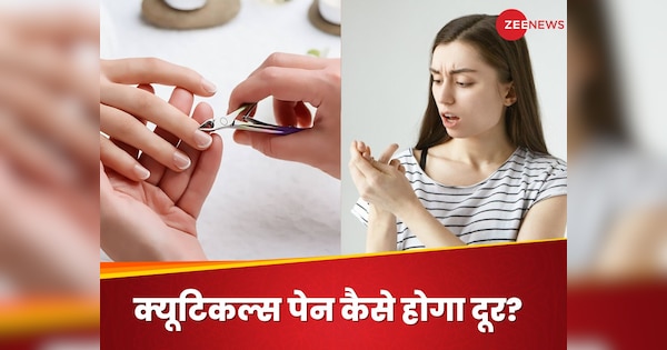 Cuticle Pain Relief Tips in Hindi Main Reason Cure Treatment ...