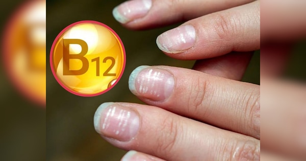 vitamin b12 deficiency | vitamin b12 deficiency symptoms | b12 ...