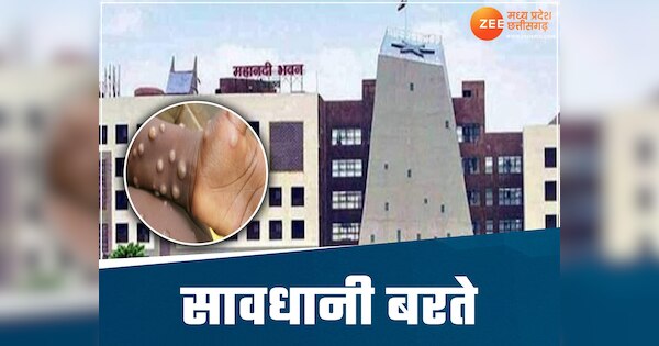 chhattisgarh govt advisory issued regarding monkey pox alert in ...