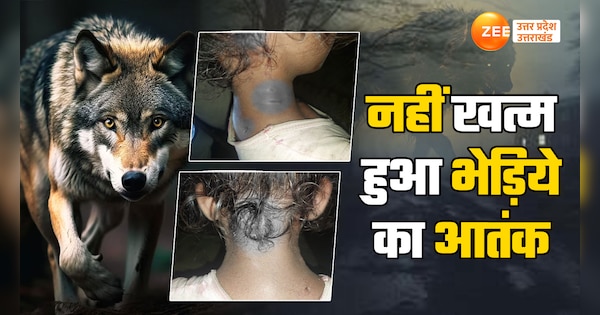 bahraich wolf attacked an 11 year old girl admitted to the hospital ...