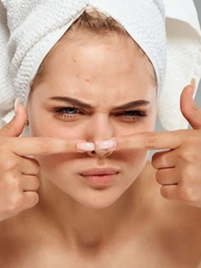 skin care tips To get rid of acne try this face pack of honey and lemon ...