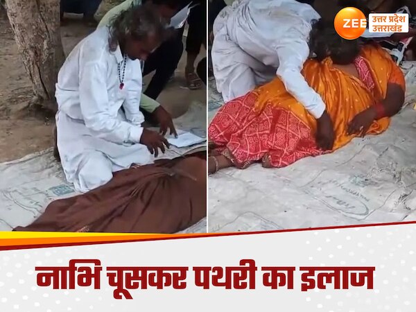Mainpuri Baba Claims to remove stones by sucking navel officials raised objection after video ...