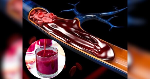 These 5 red fruits works like blood making machines iron deficiency ...