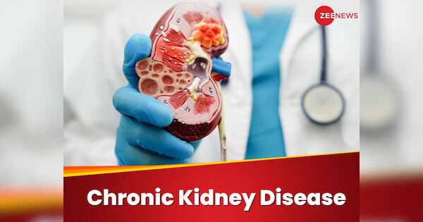 What is Chronic Kidney Disease CKD disease and its symptoms Kidney ...