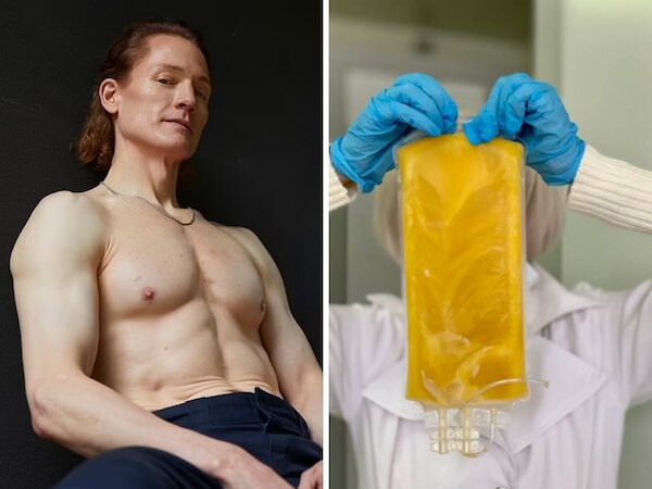 Bryan Johnson got all plasma removed from blood for anti-aging know ...