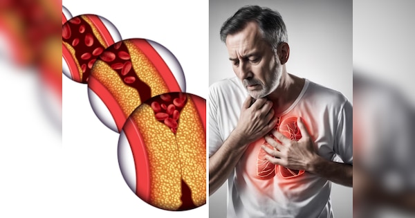 How long does it take for high cholesterol to cause heart attack| How ...