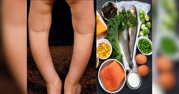 List of Top Calciferol Rich Foods Vitamin D Deficiency Disease Rickets ...