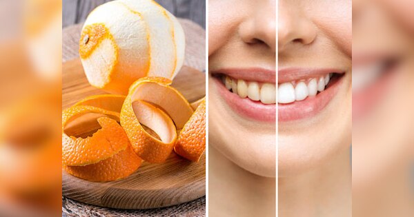 Orange peel will remove the yellow layer on teeth know how to use it ...