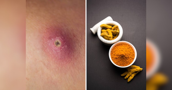 Baltod ko kaise thik kare 5 things will give you immediate relief from ...