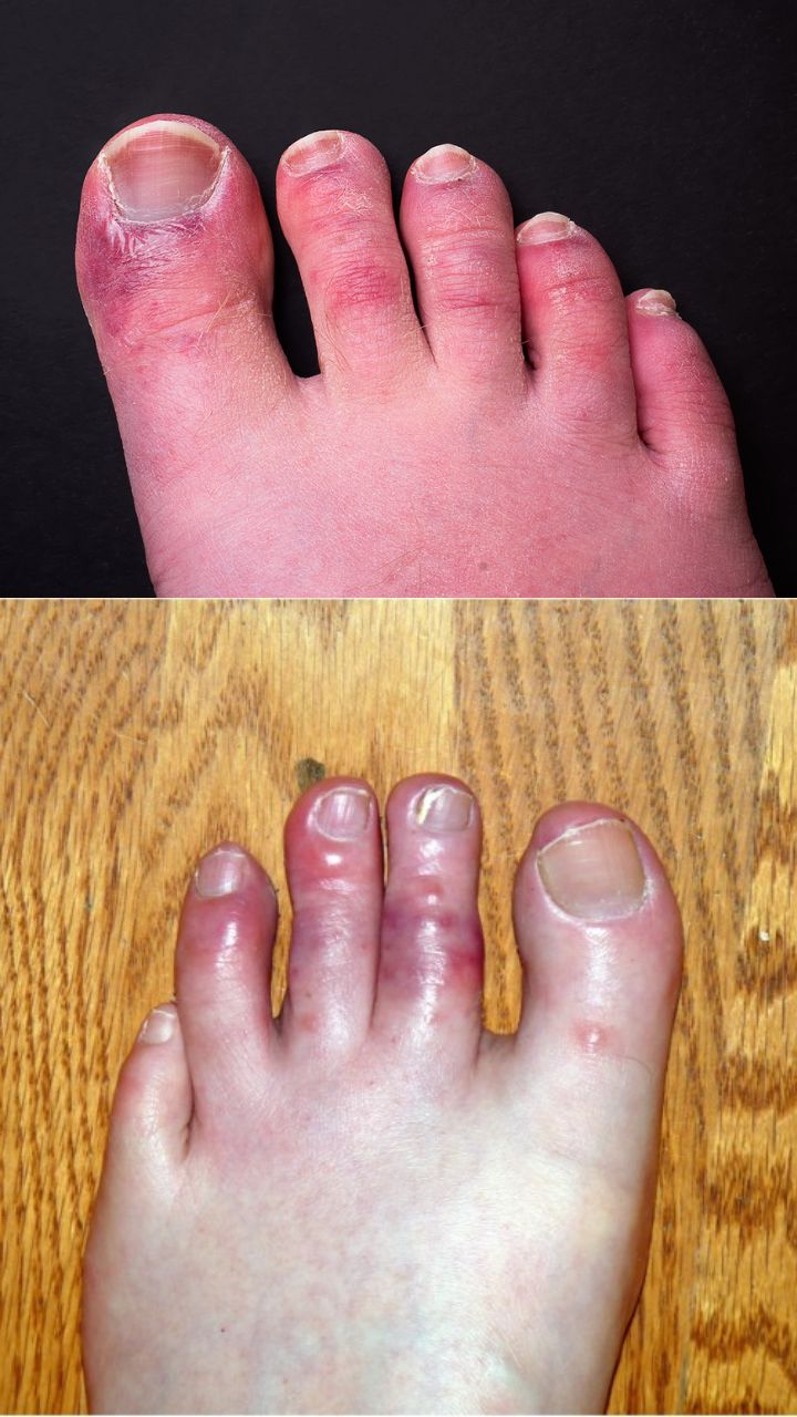 Hand Care Tips Home Remedies For Red Fingers Care Tips| Hand Care Tips ...