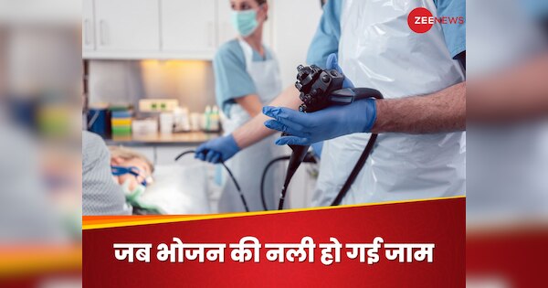 Male Patient 45 Years Old Double Obstruction in Food Pipe Successfully ...