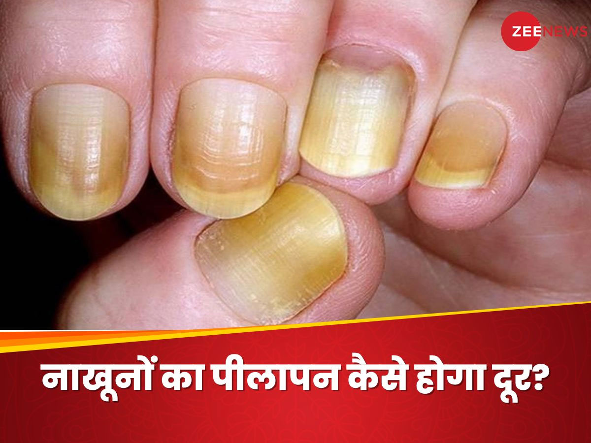 Dirty Yellow Nails Cleaning Hacks Peele Nakhun Kaise Saaf Karen Lemon ... Dirty Yellow Nails Cleaning Hacks Peele Nakhun Kaise Saaf Karen Lemon ...