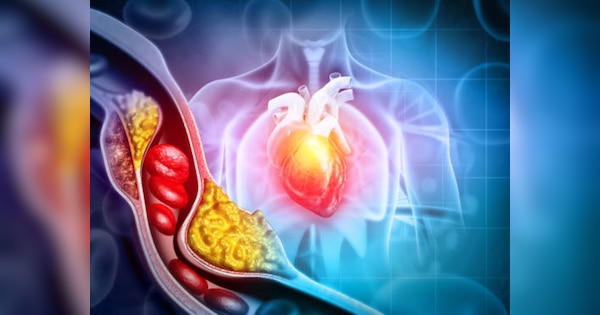 strange signs are seen when cholesterol increases in winter most of the people make mistake in ...