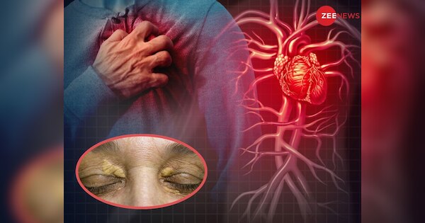 Early symptoms of heart attack eyes will alert before chest pain do not ...